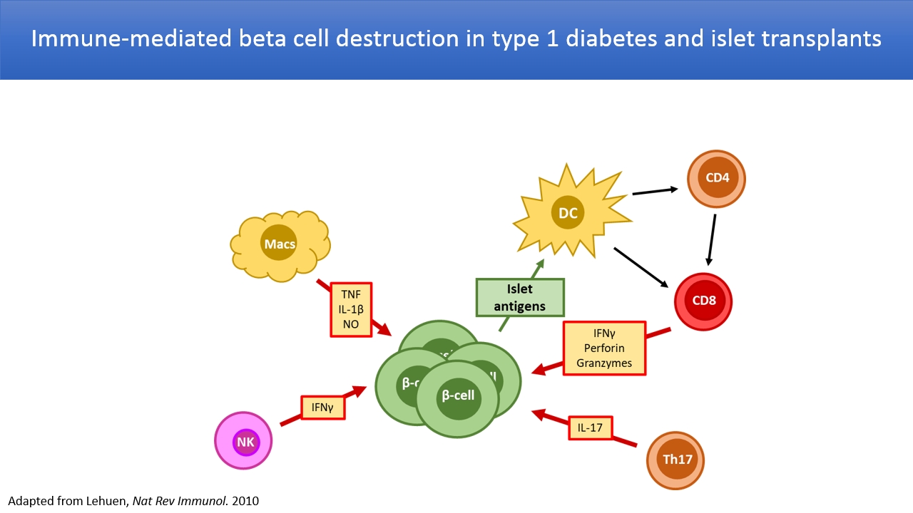 Immune Mediated Diabetes
