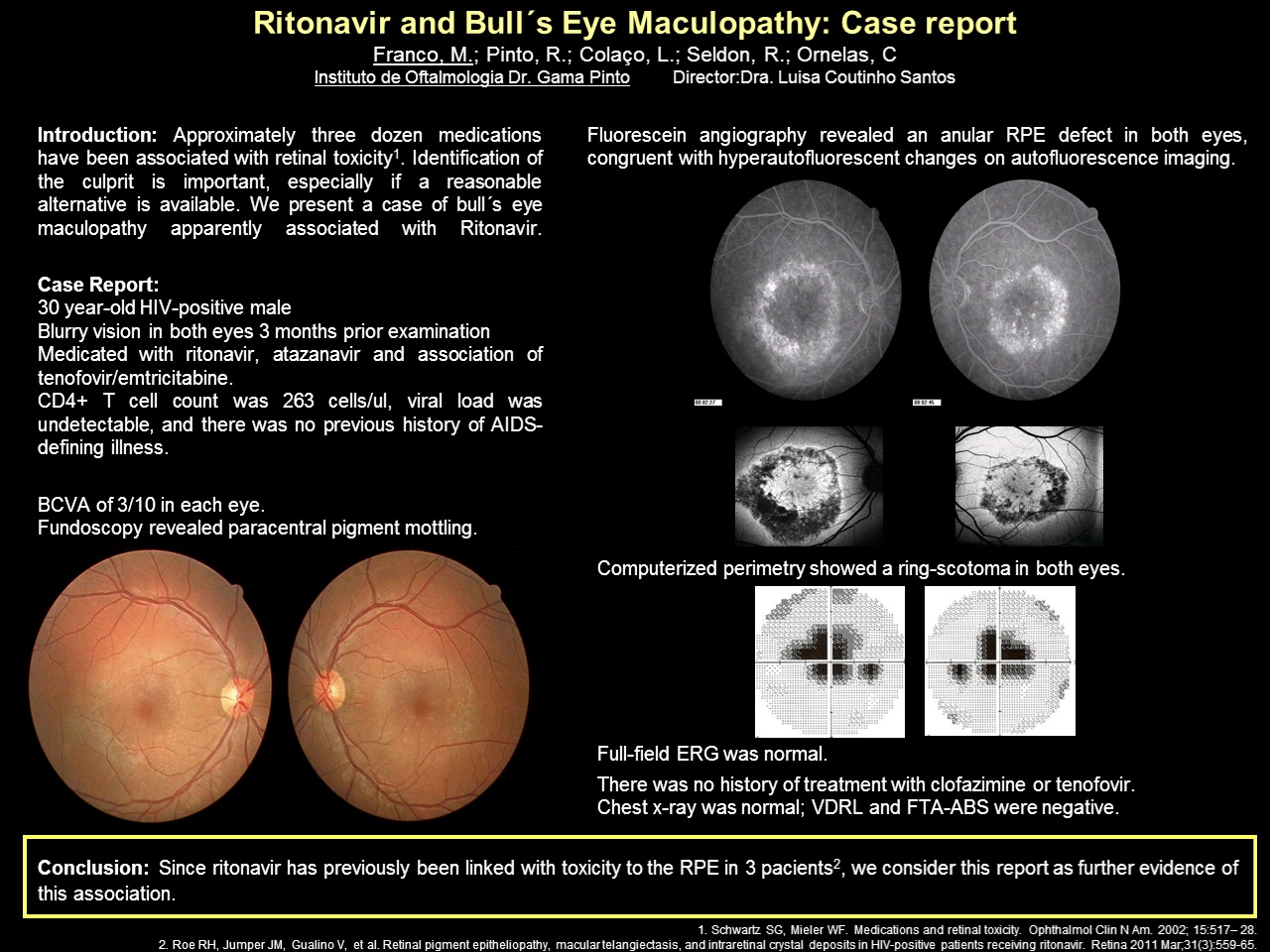 Hiv Retinopathy Oct